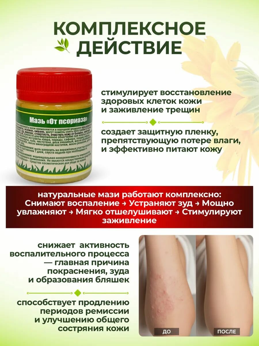 Мазь от псориаза — фото 1