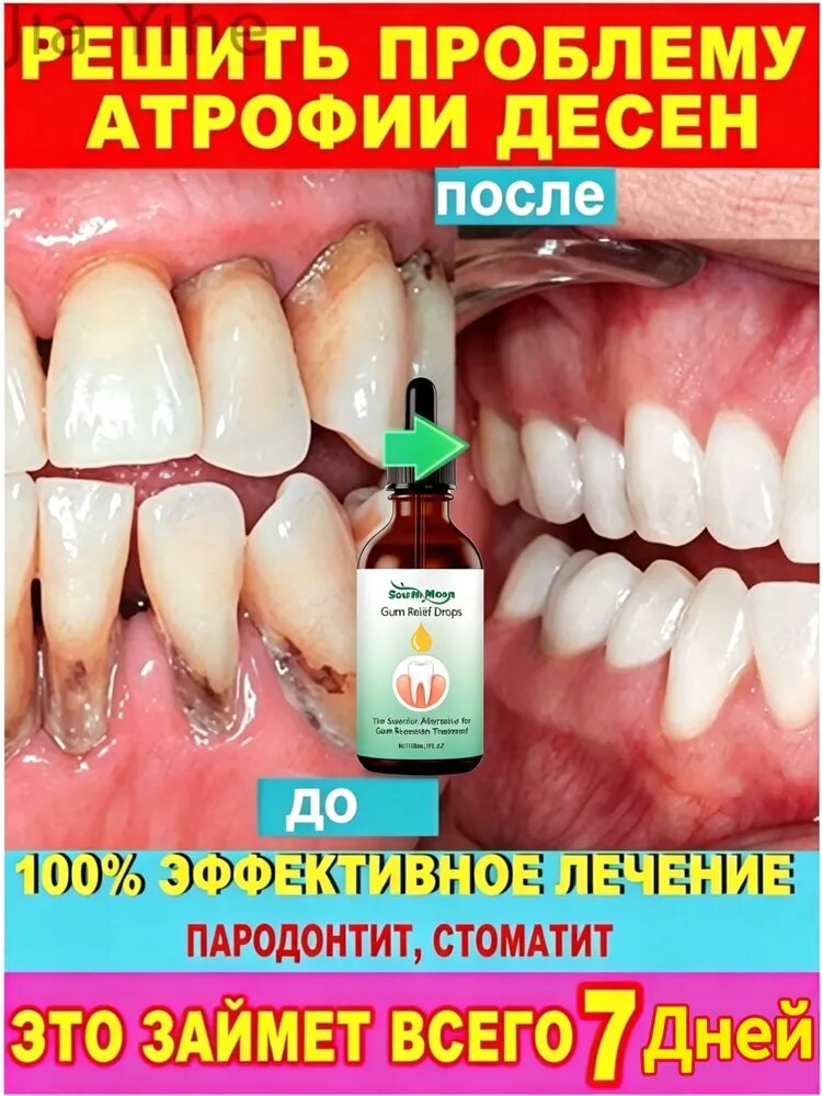 Капли для лечения десен, устраняет кровоточивость десен, предотвращает атрофию, уменьшает разрывы, Наносите на зубы и десны для комплексного ухода за полостью рта, 150 мл
