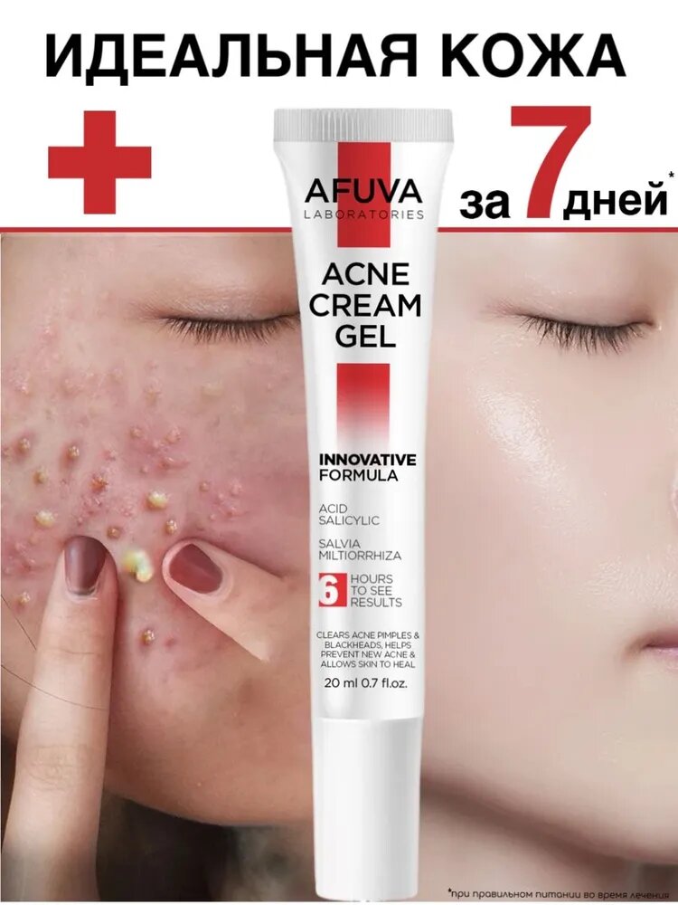 Крем-гель от прыщей, AFUVA, средство от акне, 20 ml