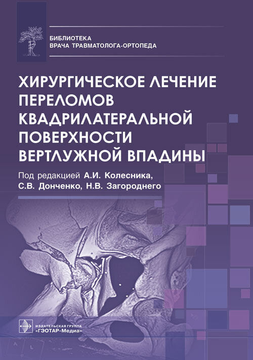 Хирургическое лечение переломов квадрилатеральной поверхности вертлужной впадины / под ред. А. И. Ко