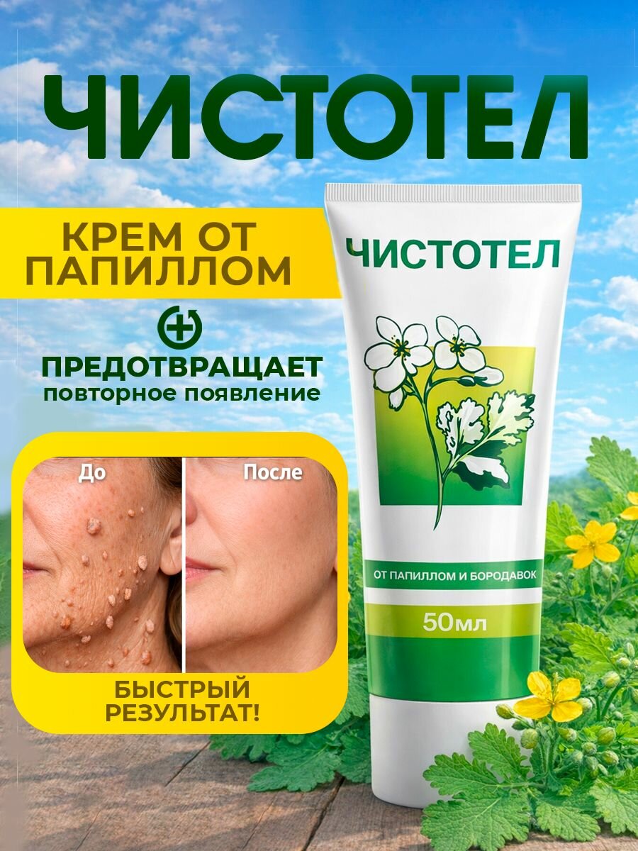 Чистотел от папиллом и бородавок 50 мл