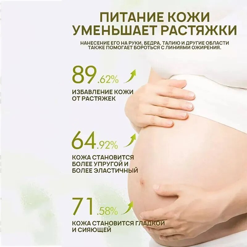 Средство от растяжек Anti-Stretch Mark Cream 100 мл — фото 1