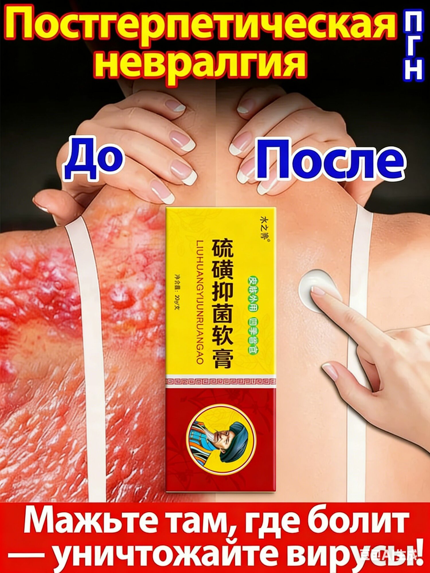 Мазь при опоясывающем лишае снятие боли и зуда