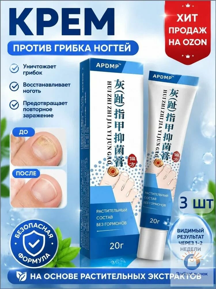 3 штуки, крем ноготок от грибка ногтей на ногах, гиперкератоз против грибка ногтей от гиперкератоза