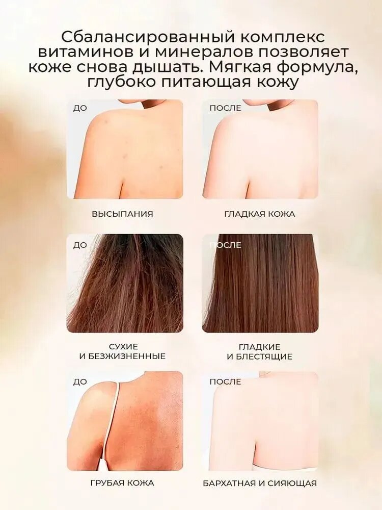 Фильтр для душа — фото 1