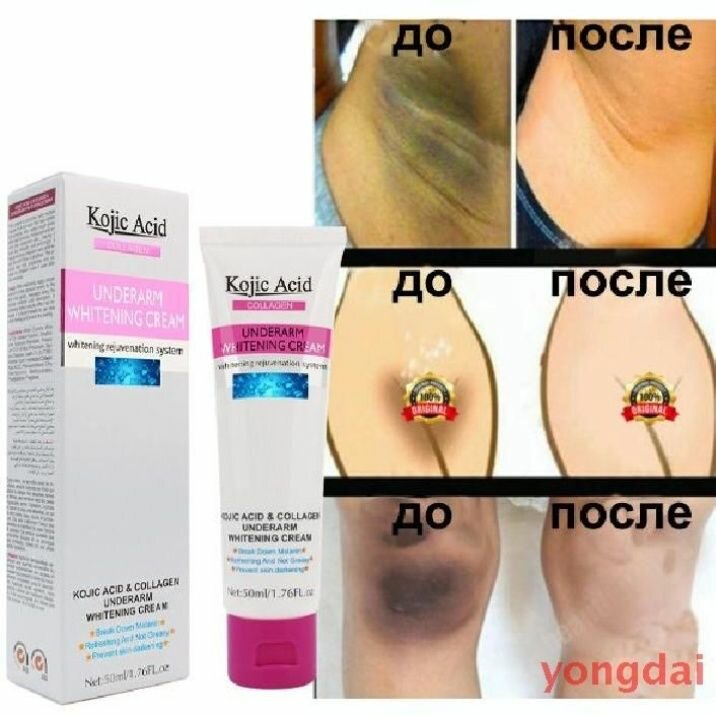 Женский отбеливающий крем для тела, крем для подмышек, крем для интимной зоны, Удаляет пигментацию меланина Питает и осветляет Уход за кожей 60г