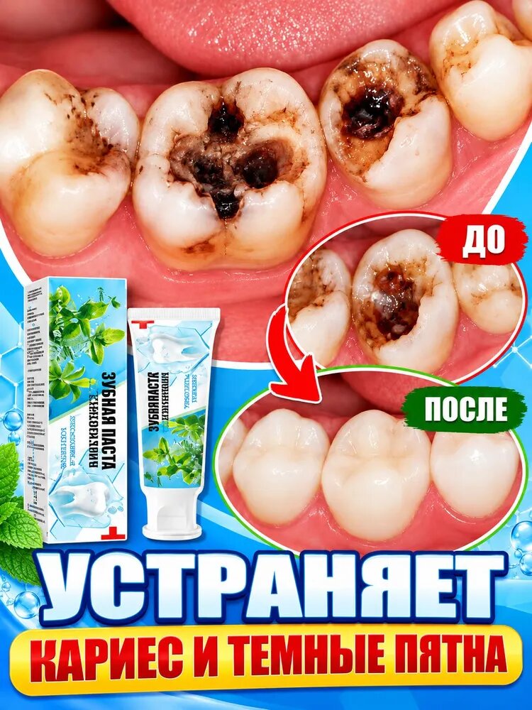Зубная паста для лечения кариеса и отбеливания зубов, с натуральными ингредиентами для свежего дыхания, 300 г.