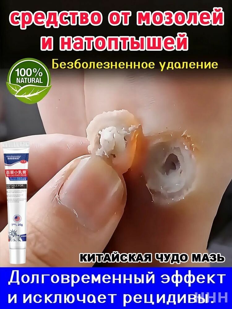 Пластырь от мозолей стержневых и натоптышейКрем для ног 20 г