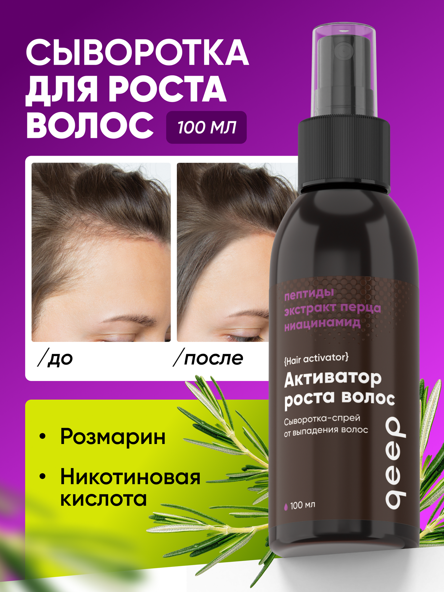 Спрей для роста и от выпадения волос, сыворотка для роста волос активатор qeep 100 мл