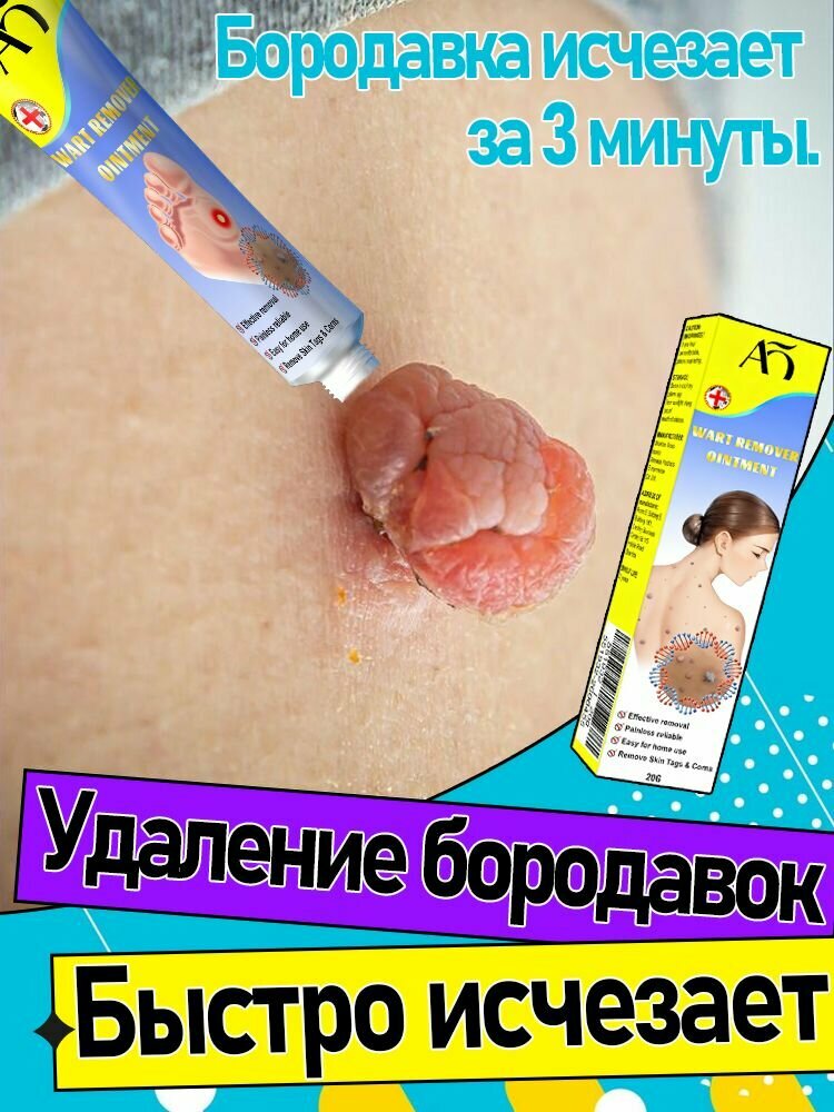 Крем от бородавок, который безболезненно удаляет бородавки, папилломы и родинки, не оставляя шрамов и побочных эффектов. Изготовлен на основе растительных экстрактов. 200 грамм. удаление папиллом удаление родинок безболезненное удаление рас