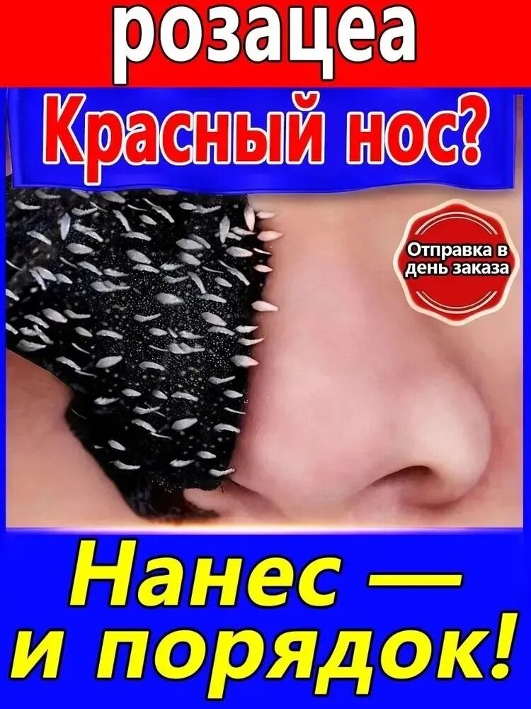 Мазь от розацеа, снижает покраснение носа, устраняет припухлость, гиперемию и жирность кожи, 20 г