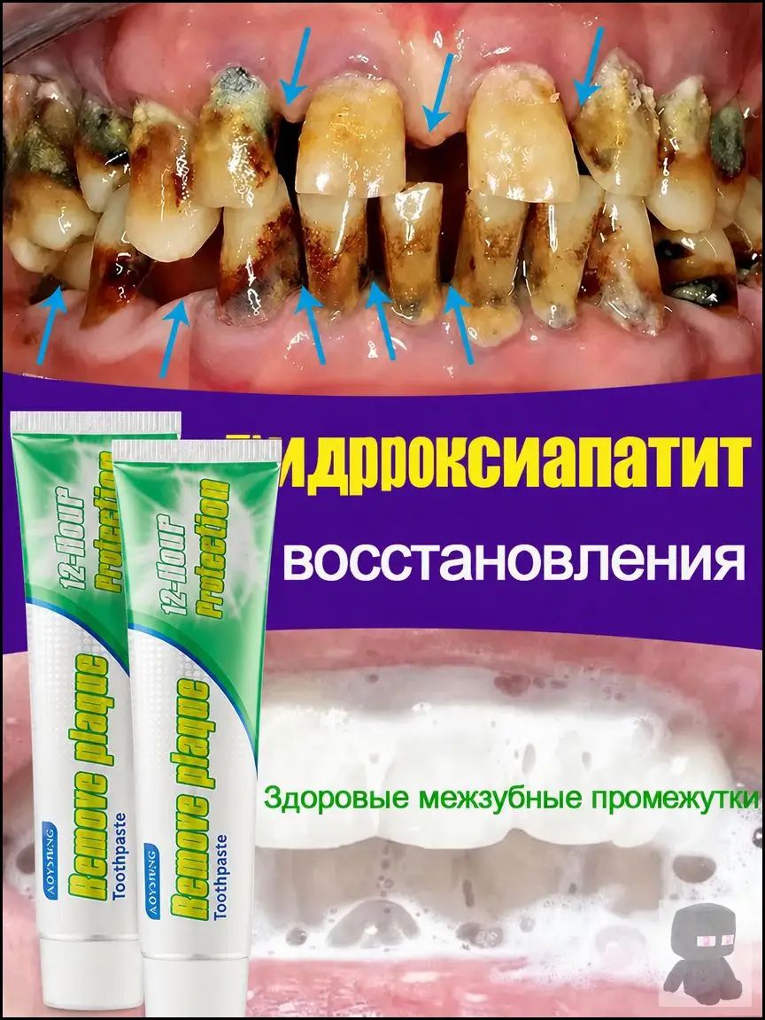 Быстро удаляют зубной камень, Удаляет желтые зубы, неприятный запах изо рта, зубной налет и пятна от дыма 100 г.