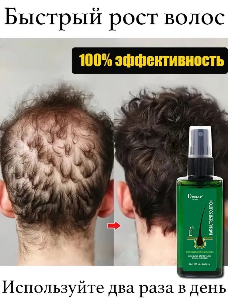 Средство против выпадения волос, активатор роста и густоты волос, подходит для мужчин и женщин, 120 мл