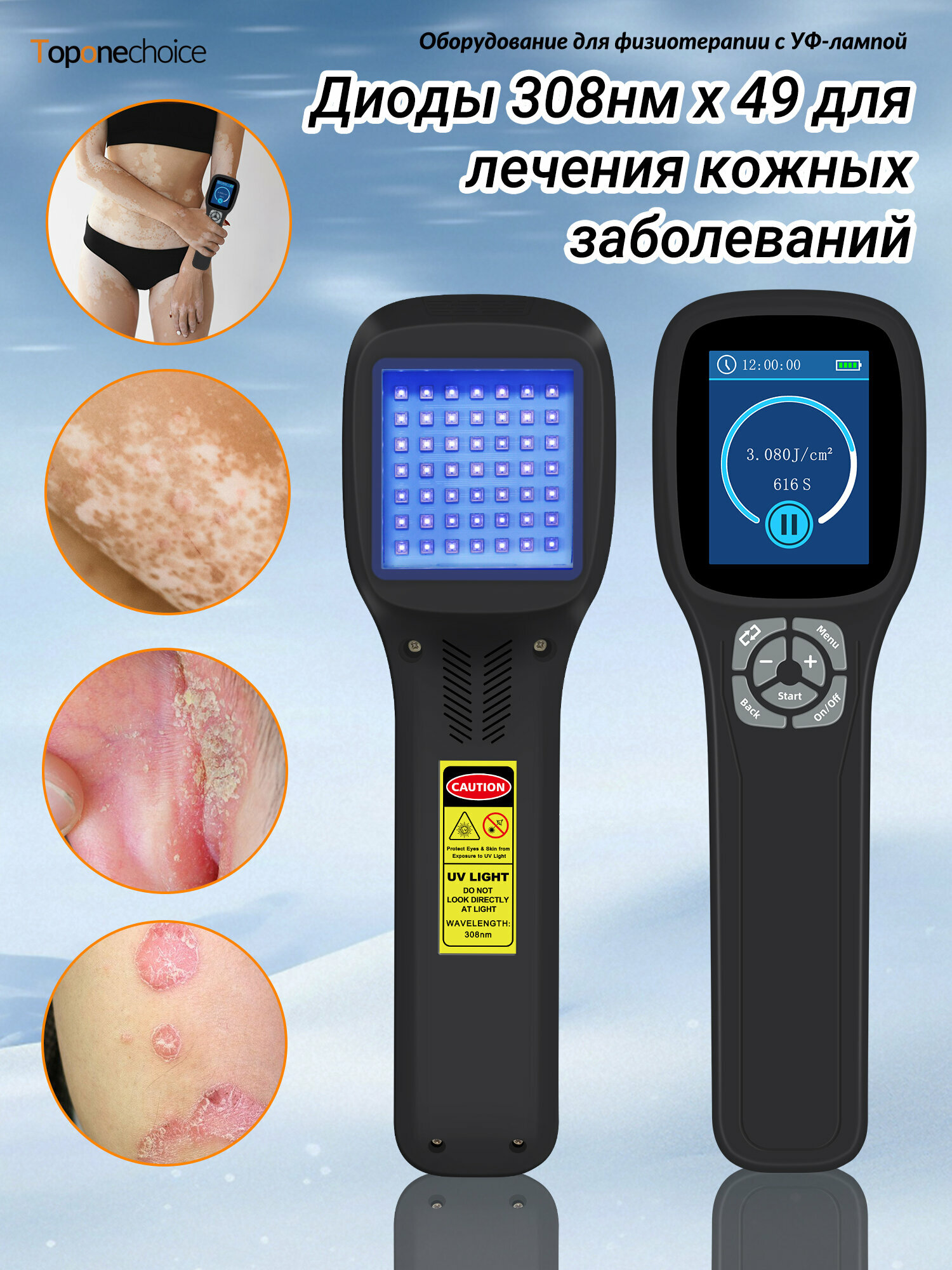 Портативный УФ прибор Toponechoice 308 нм 49 LED Целевой эффект Интенсивность 5-40 мВт см² Витилиго псориаз дерматит