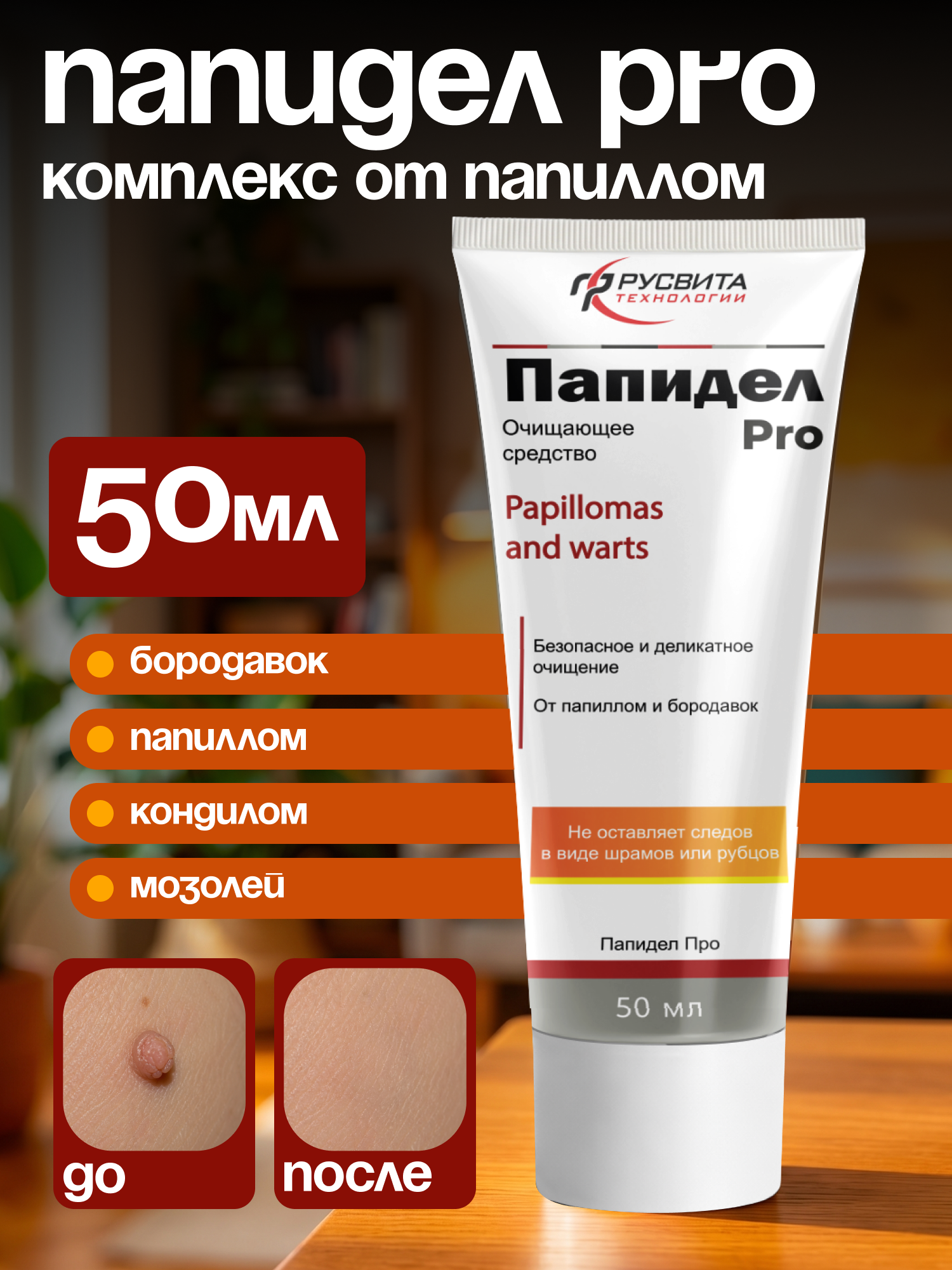 Папидел PRO — очищающее средство от папиллом, бородавок и сухих мозолей, туба 50 мл