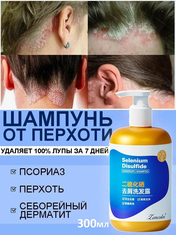 Борется с перхотью, зудом и себорейным дерматитом, подходит для нормальных и жирных волос, восстанавливает поврежденные волосы, 300 мл