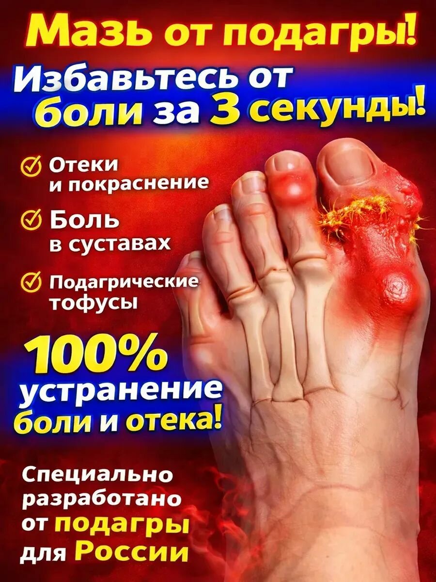 Мазь от подагры на ноге и для рук и артрита 55 г
