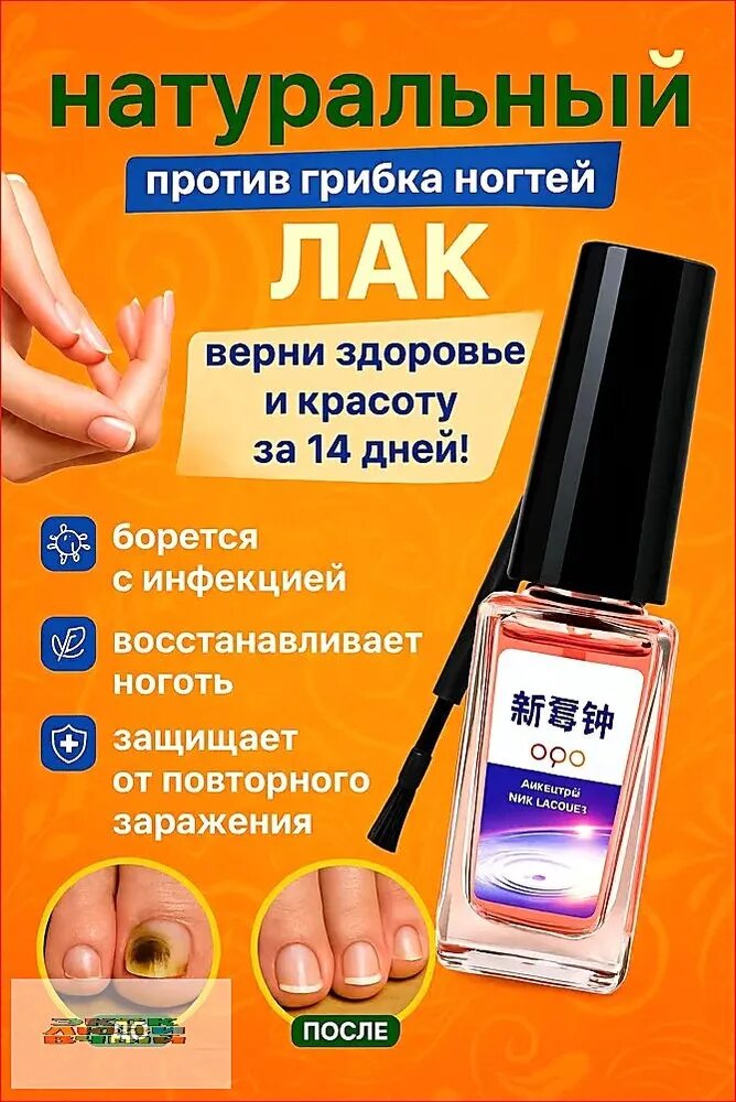 Средство от грибка ногтей на ногах и руках, масло от грибка ногтей на ногах , 5 ml