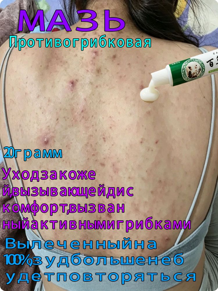 Антибактериальный крем от инфекций / Китайская чудо мазь, устраняет половой грибок, запах, зуд, восстанавливает микробиом кожи