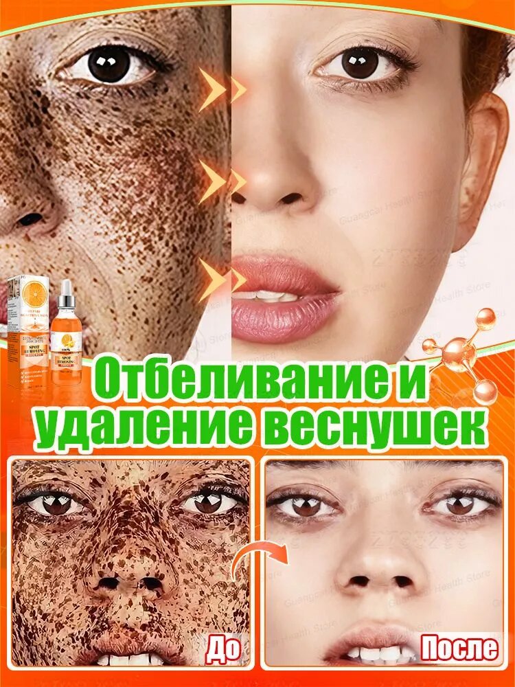 POZOAMIS-16S Концентрат для ухода за кожей, 150 мл
