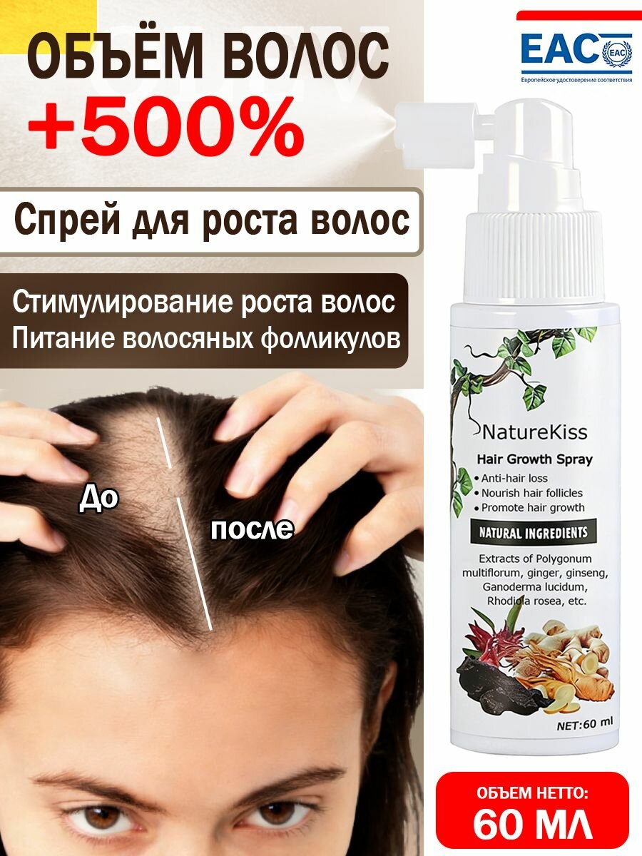 NatureKiss Спрей для роста волос, с активными растительными компонентами, предотвращает выпадение и стимулирует рост волос, 60 мл, для мужчин и женщин