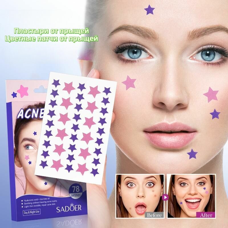 Пластырь От Прыщей, Уход За Кожей, Восстановление Кожи, Цвет Удаления Прыщей