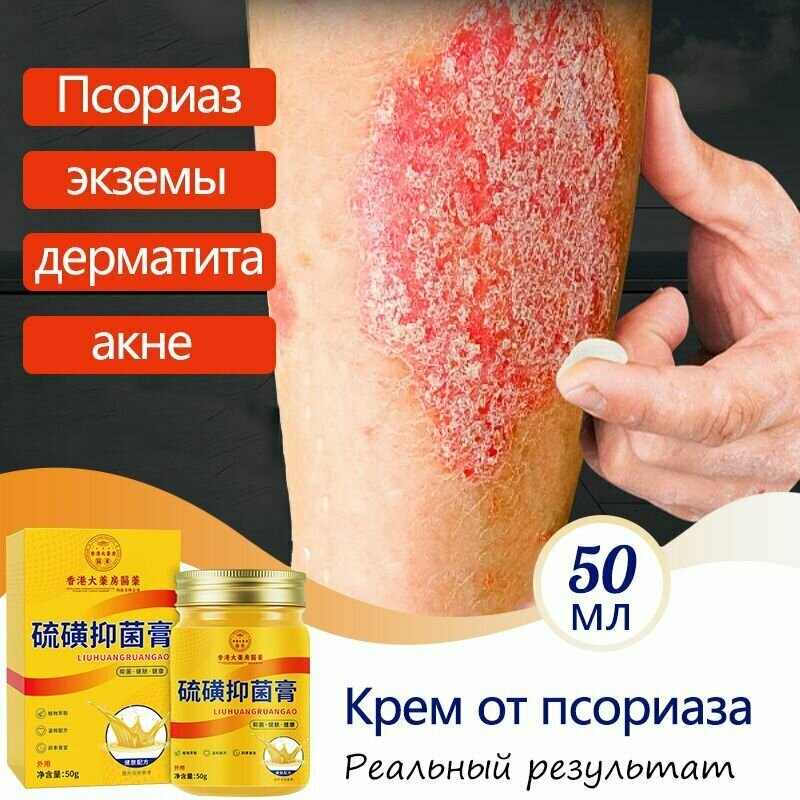 Крем от псориаза, от акне, крем для тела, от экземы, от дерматита / 50 мл Натуральный негормональный крем Антибактериальная мазь