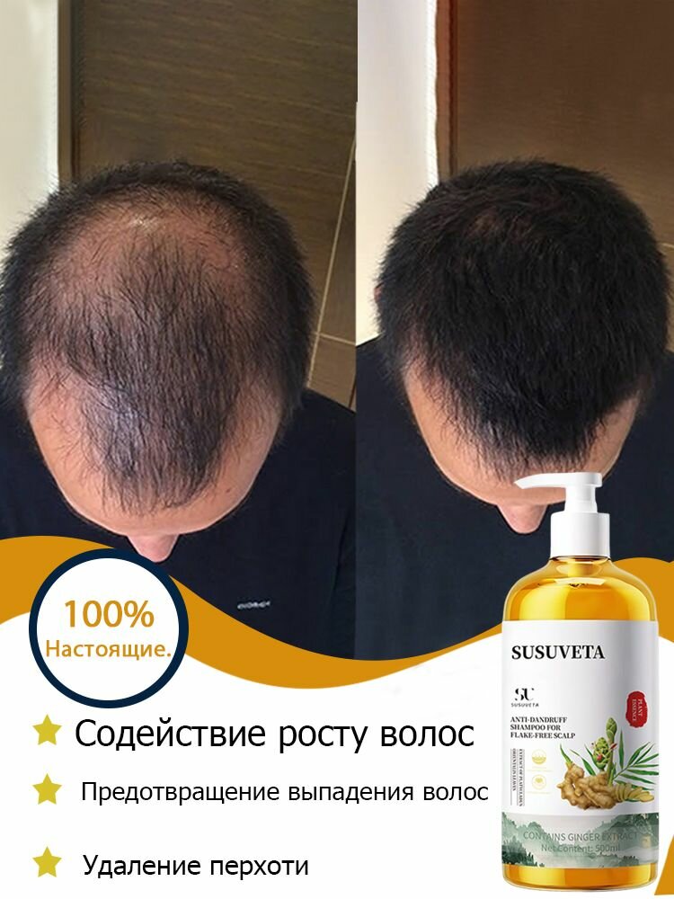 Herbal эссенция Шампунь от выпадения волос для женщин мужчин лечебный, средство от облысения алопеции, активатор роста для густоты волос,500 мл