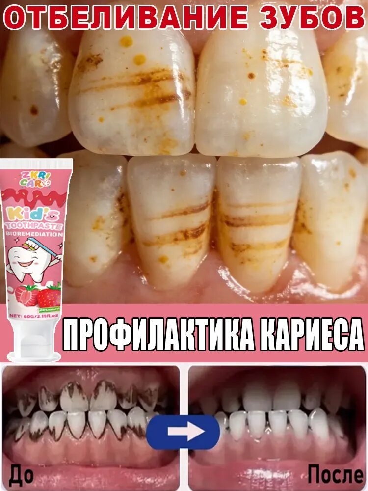 Детская зубная паста, прочная зубная эмаль, профилактика кариеса, защита молочных зубов, уход за полостью рта, для чувствительных зубов и десен, нежная формула, подходит для детей в возрасте 6-12 лет