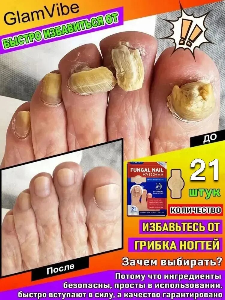 Антигрибковый пластырь для ногтей на ногах,21 шт.