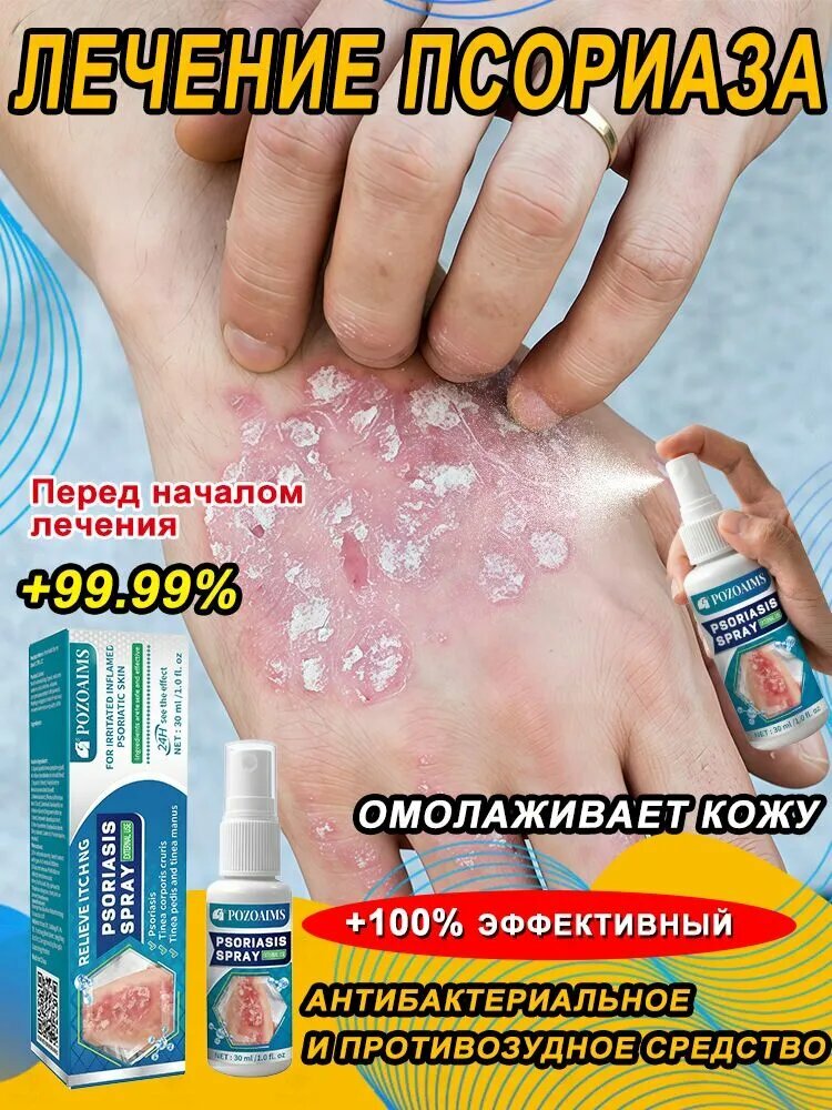 Натуральный негормональный спрей от псориаза быстро снимает зуд и шелушение, восстанавливает кожу. Для головы, рук, ног и тела. Лечение дома.