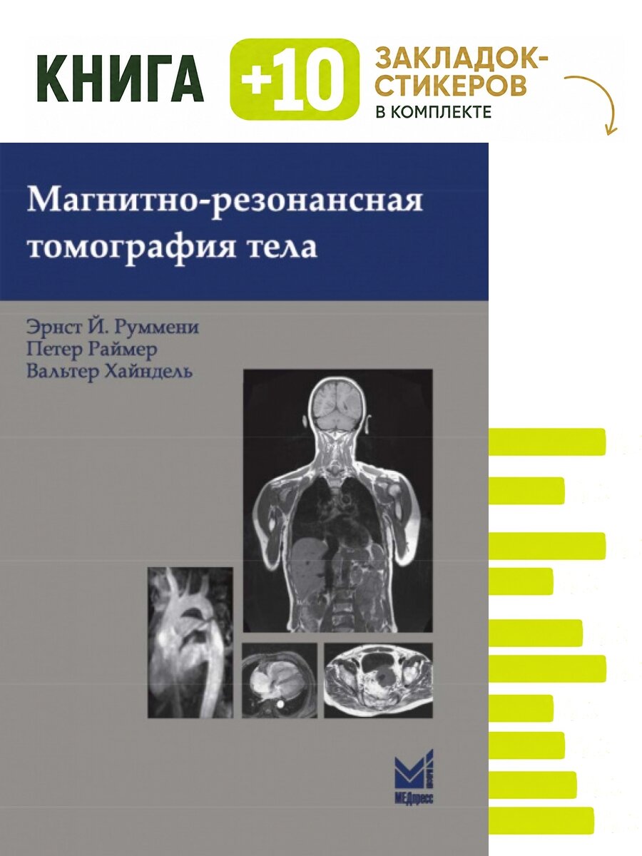 Магнитно-резонансная томография тела. Комплект: книга + 10 закладок-стикеров