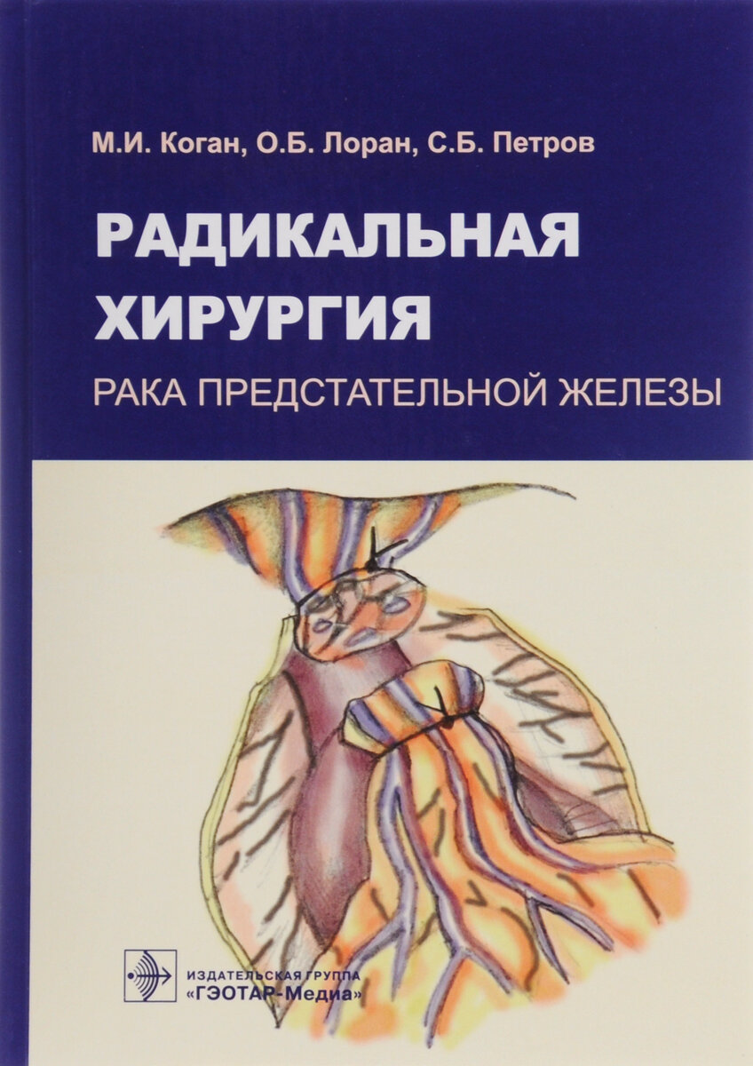 Радикальная хирургия рака предстательной железы.