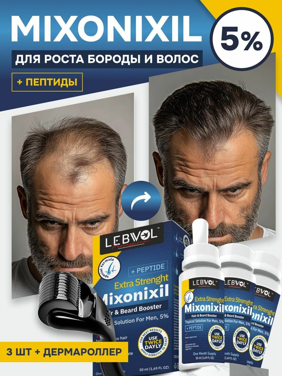 Mixonixil 5% Средство для роста бороды волос и усов / Сыворотка против облысения у мужчин / Лосьон от выпадения волос
