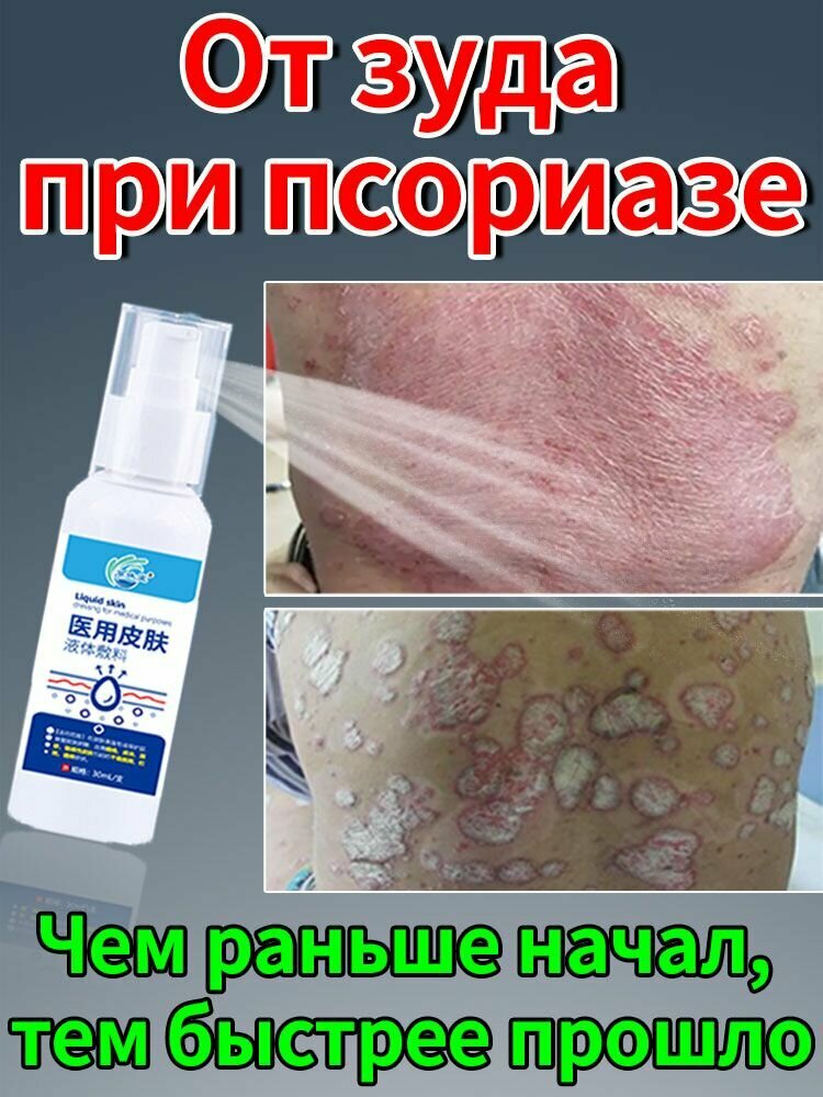 Псорифенак мазь от псориаза 30 мл