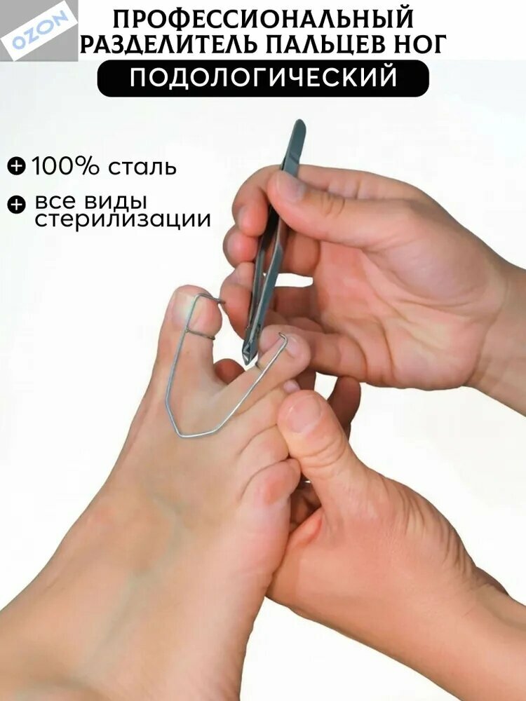 Разделитель для пальцев ног подологический.