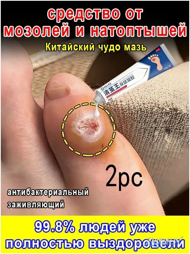 Пластырь от мозолей, стержневых натоптышей и бородавок 40 г Китайский чудо мазь