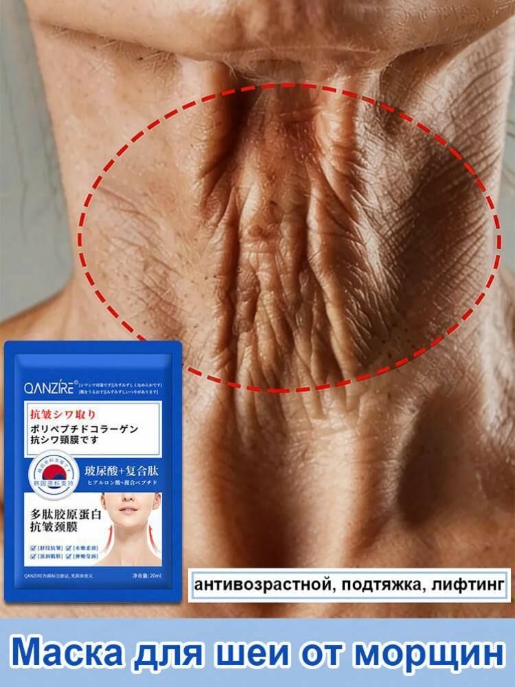 Патчи