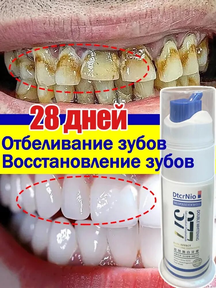 Быстро удаляют зубной камень, Удаляет желтые зубы, неприятный запах изо рта, зубной налет и пятна от дыма