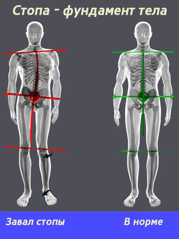 Стельки супинаторы Walk FIT для стопы, защита от плоскостопия и шпоры, белые, 1 пара — фото 1