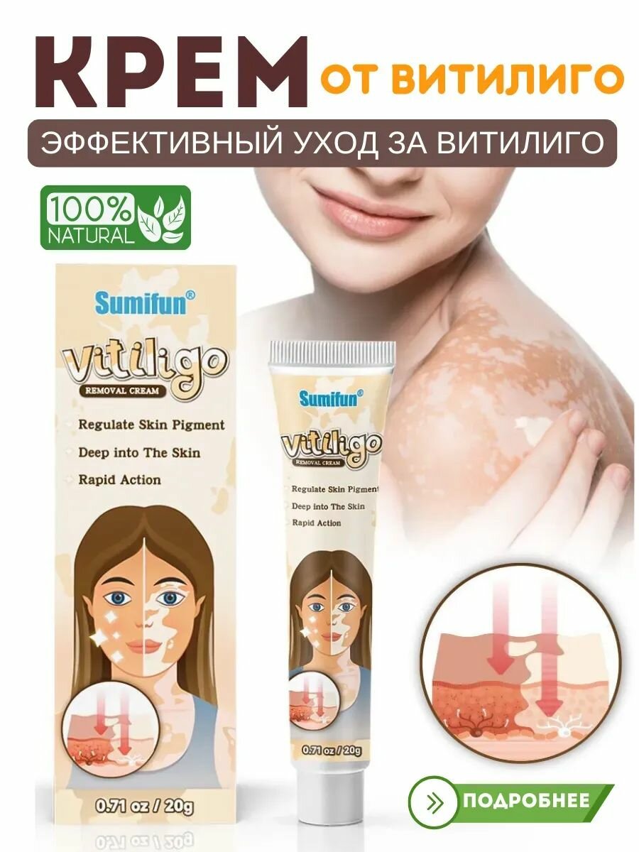 Антибактериальный крем от Витилиго против пигментации