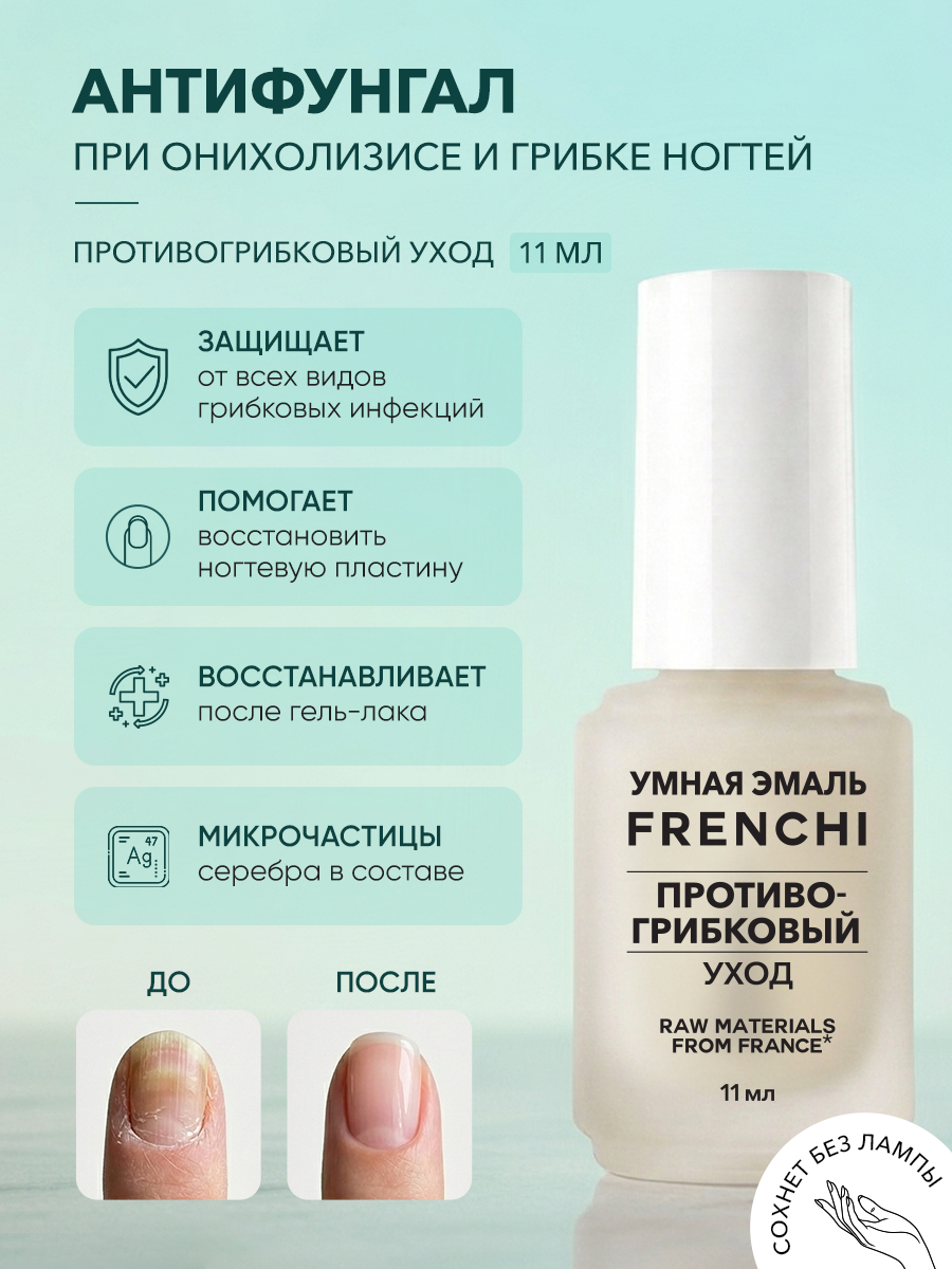 Антифунгал лак для ногтей противогрибковый уход для взрослых и детей FRENCHI Умная Эмаль , 11 мл.
