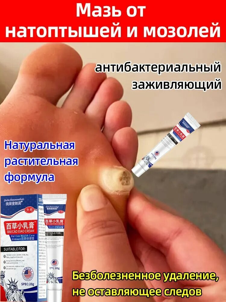 Mазь от мозолей стержневых и натоптышей , Крем от сухих мозолей, шипицы, бородавок, натоптышей,20 г.