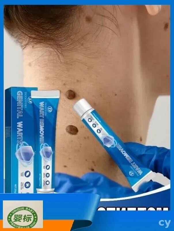 LUKAOHUA / Мазь от бородавок, Крем средство для удаления бородавок, папиллом и родинок, безболезненно, не оставляет следов без побочных эффектов / 20г