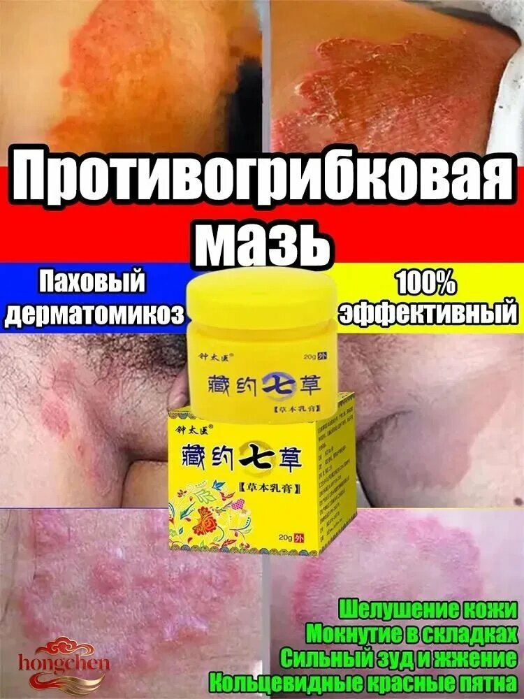 Паховый грибок противогрибковая мазь для кожи，Сливки 20 г，Крем для кожи