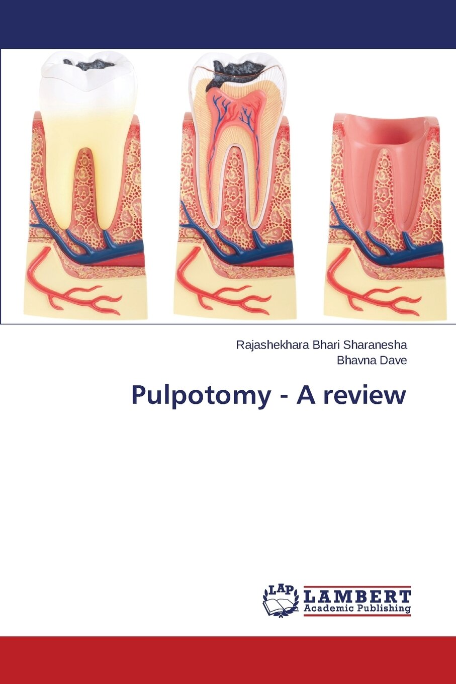 Pulpotomy - A review — фото 1