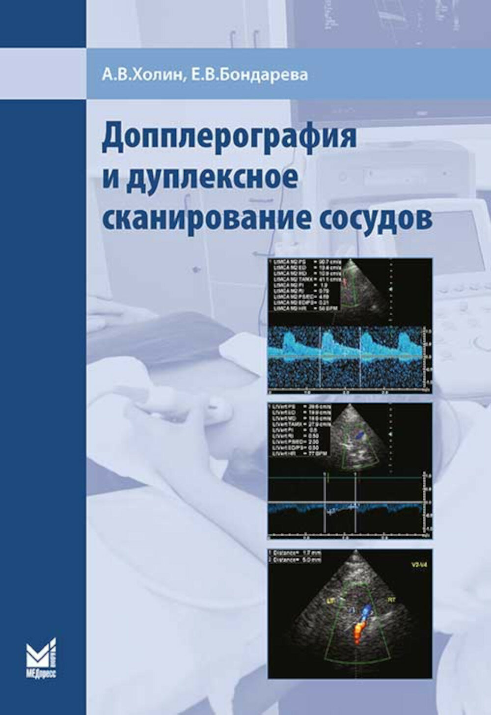 Допплерография и дуплексное сканирование сосудов. 3-е изд. Холин А. В, Бондарева Е. В.