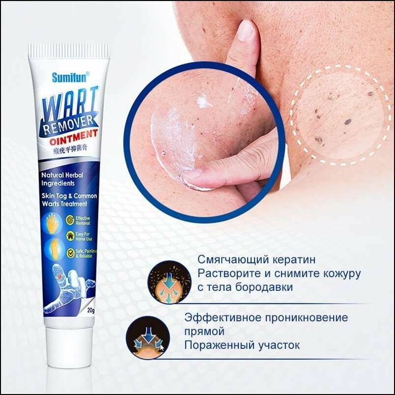 Крем-гель от бородавок, Средство от папиллом и бородавок, мазь для ухода за кожей 20 мл