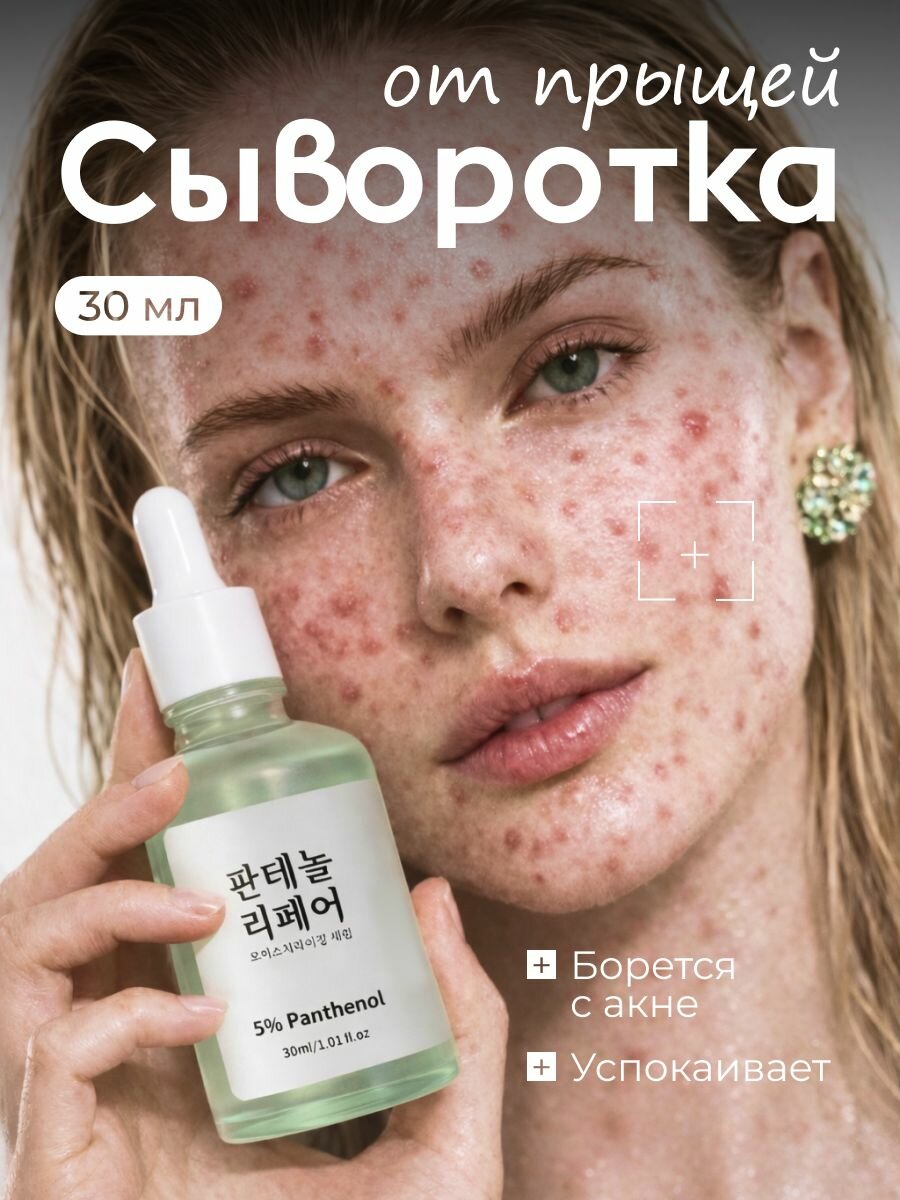 Средство от прыщей на лице, крем / сыворотка от прыщей, для сужения пор, "Comedon", 30 мл