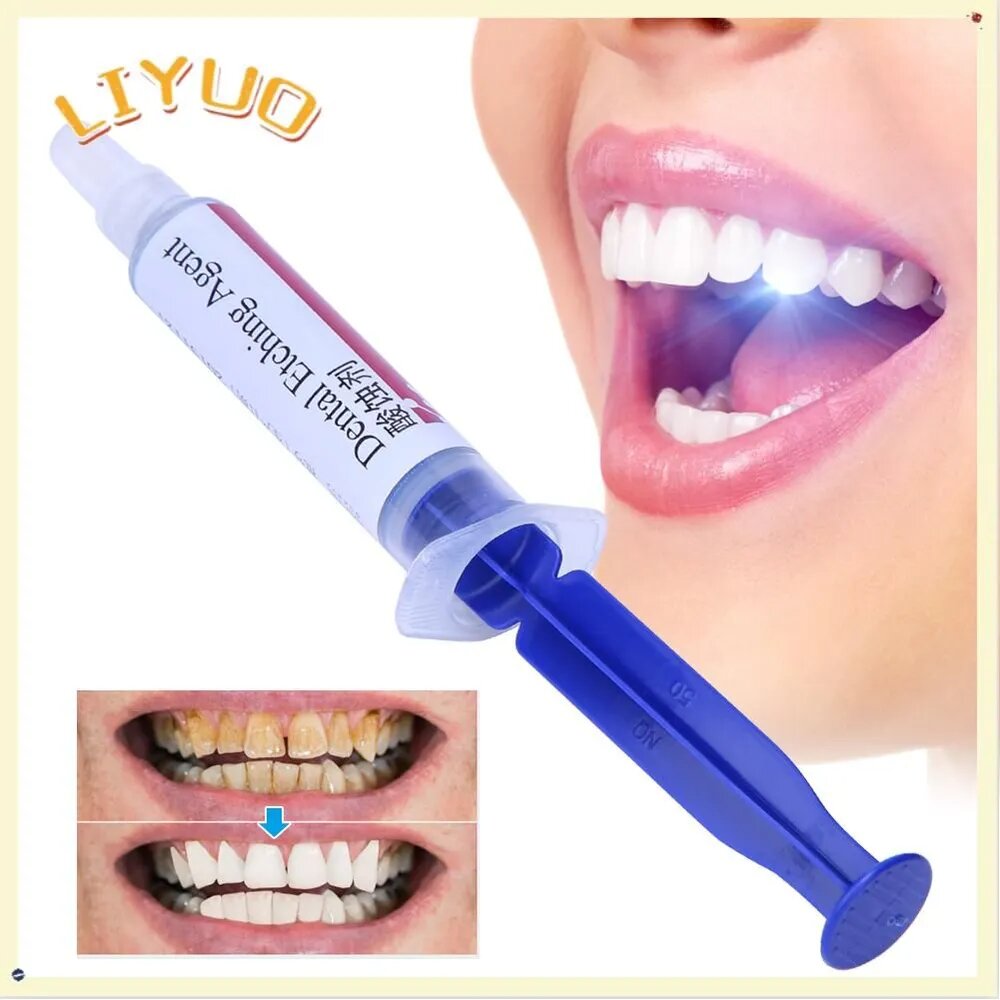 Стоматологический травление